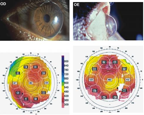 Prova CBO 2009 | Teórico Prática | Questão 30 - Banco de questões ...